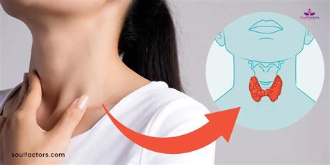 What Are Early Warning Signs Of Thyroid Problems What To Do