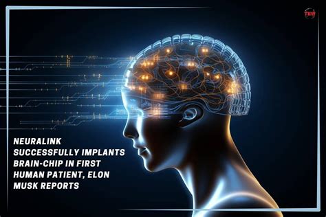 First Brain Computer Interface Neuralink Successfully Implanted The