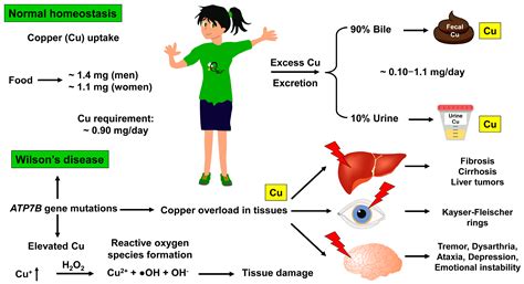 Comprehensive Pharmacological Management Of Wilsons Disease