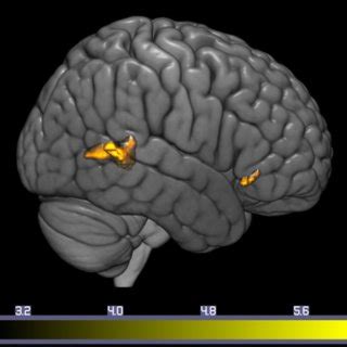 Sex Related Differential Activity Men Women Post Hoc T Test Punc Download Scientific Diagram