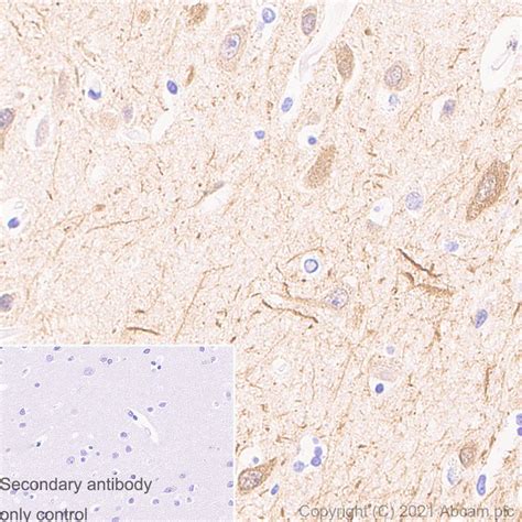 Anti Map2 Antibody [rm1037] Neuronal Marker Ab288714 Abcam