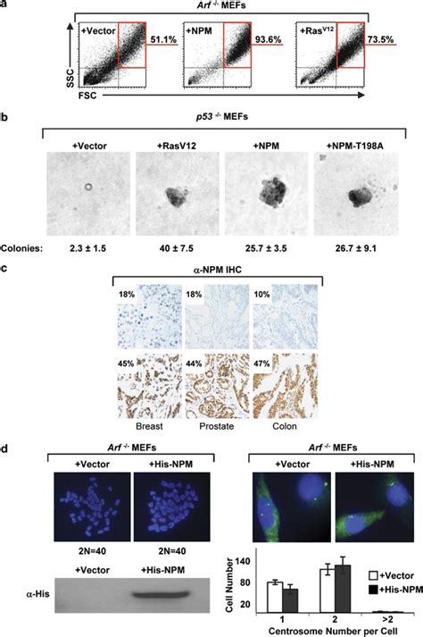 Nucleophosmin Npm Drives Oncogenic Growth And Proliferation A Download Scientific Diagram