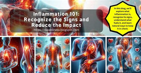 Inflammation 101 Recognize The Signs And Reduce The Impact