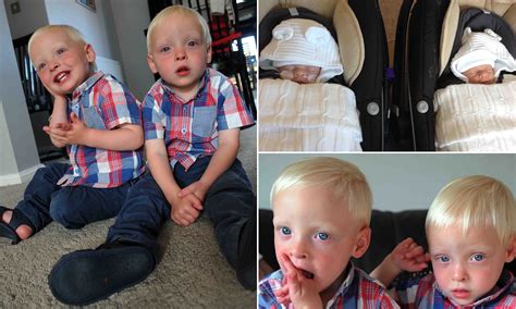 Identical Twins Mirror Organs At Tina Lown Blog