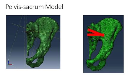 Questions With Answers In FINITE ELEMENT ANALYSIS Science Topic