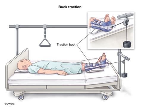 Med Surg Exam 4 Musculoskeletal Flashcards Quizlet