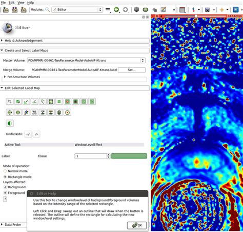 Documentation Nightly Extensions Windowleveleffect Slicer Wiki