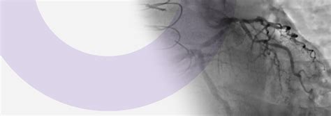 Multi Vessel Disease Boston Scientific