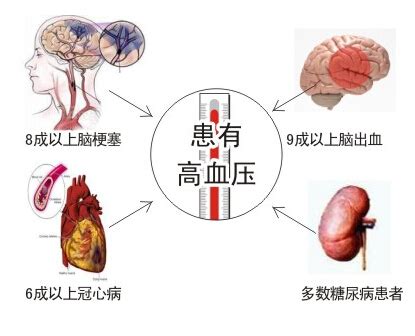 Plos Medicine：高血压患者不易得老年痴呆？
