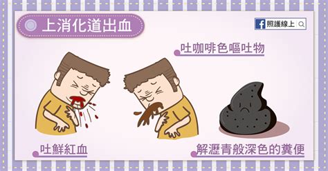 照護線上吐血拉血解黑便當心消化道出血 自由評論網
