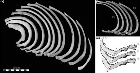 Rib Sequencing And Identification A Right St To Th Ribs Arranged