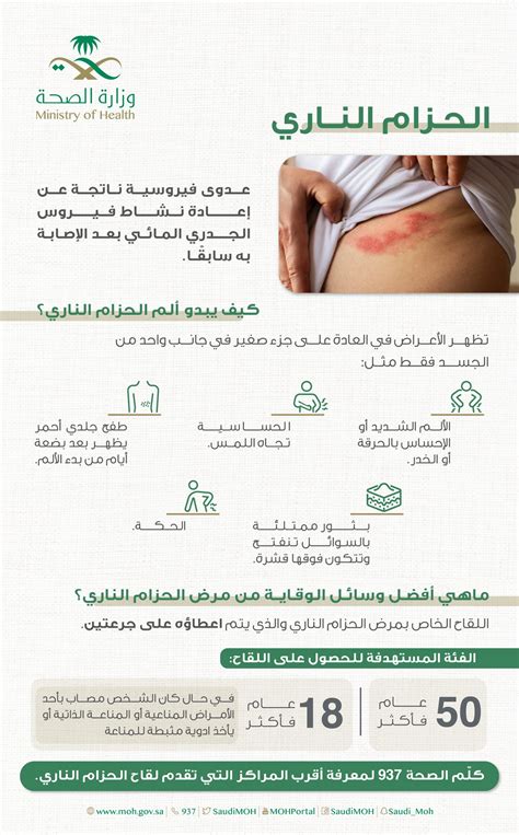 مجلة الجودة الصحية الصحة تُعرّف بمرض الحزام الناري وأبرز أعراضه وطرق