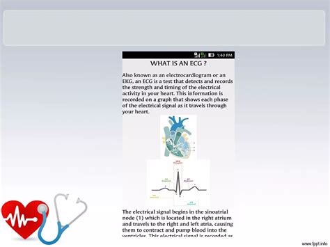Ecg Monitoring System Ppt