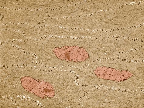 Epithelial Cells Tem Stock Image C056 0554 Science Photo Library