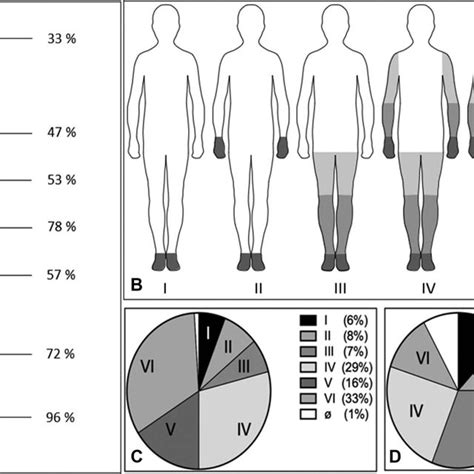 Sensory Symptom Distribution Patterns Visualization Of The Symptom