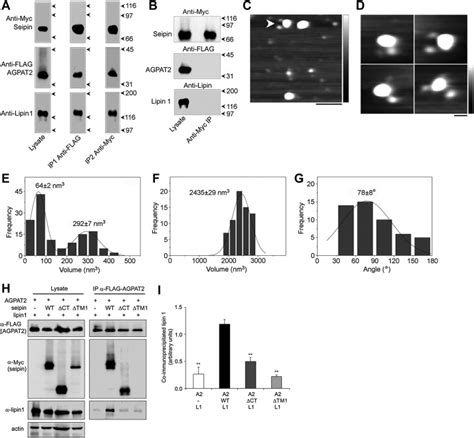 Seipin Forms A Triple Complex With AGPAT2 And Lipin 1 A Seipin Myc