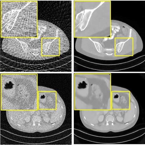 The Proposed Deep Residual Learning Architecture For Sparse View Ct Download Scientific Diagram