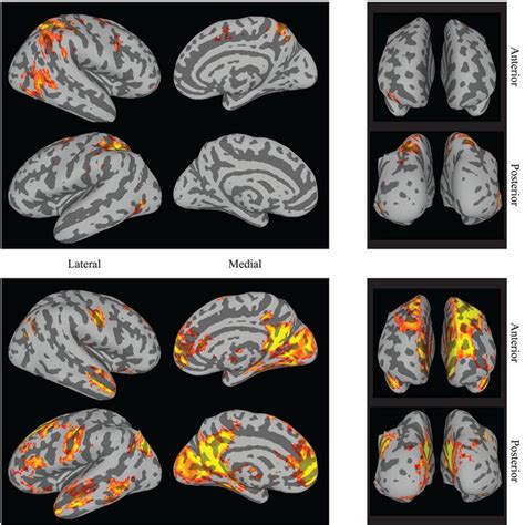 Whole Brain Effects Of Neuromodulation Type The Results Indicate Download Scientific Diagram