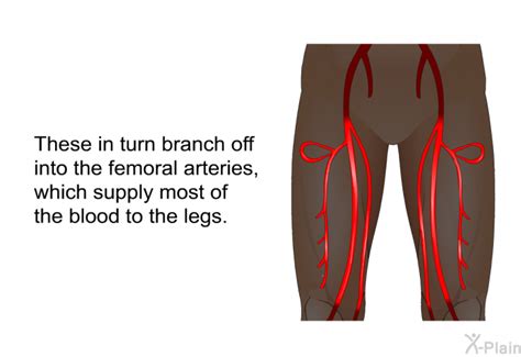 Femoro Popliteal Bypass