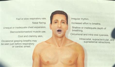 EMT Module Exam Flashcards Quizlet