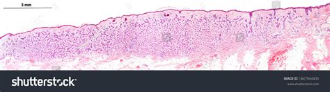 5 122 Cutanous Royalty Free Photos And Stock Images Shutterstock