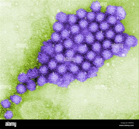 This Transmission Electron Micrograph Tem Revealed Some Of