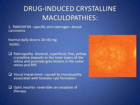 Ocular Side Effects Of Systemic Drugs