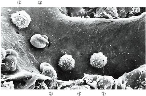 人骨髓窦状毛细血管 妇产科学 医学