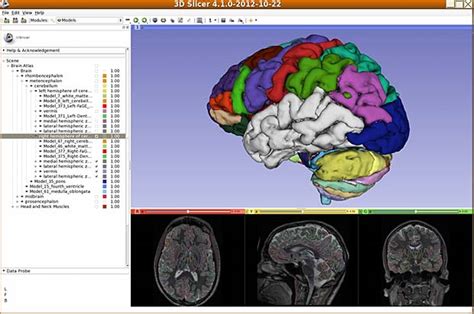 Dicom Image Viewers Internet With A Brain