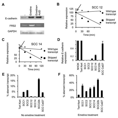 Aberrant Transcripts In Primary Human Tumor Tissues A Schematic