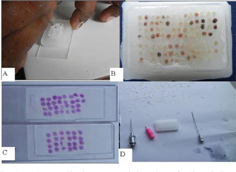 Figure 3 From A Simple And Cost Effective Technique For Construction Of
