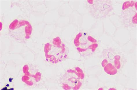 Neisseria Gonorrhoeae Microscope