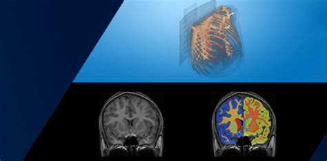 עובדים עם דימות רפואי Medical Imaging Toolbox של MATLAB כאן עבורכם Systematics
