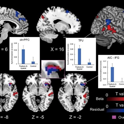 Inter Brain Synchronization Of The Brain Activity During The Ja Task Download Scientific