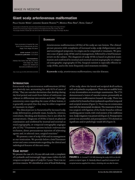 Pdf Giant Scalp Arteriovenous Malformation Scielo · Arteriovenous Malformation Draining Into