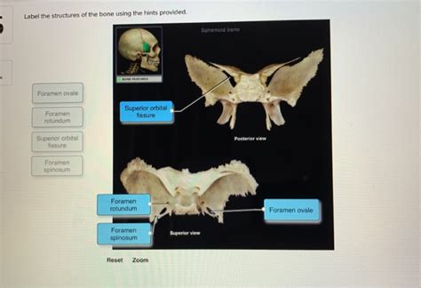 Solved Label The Structures Of The Bone Using The Hints