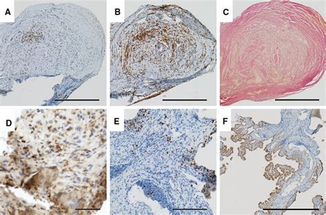 Representative Sections Of Choroid Plexus Tissue Plug Extracted From A Download Scientific