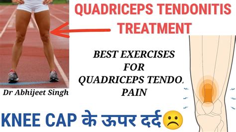 Quadriceps Tendinopathy 4 Essential Exercises For Effective Quadriceps