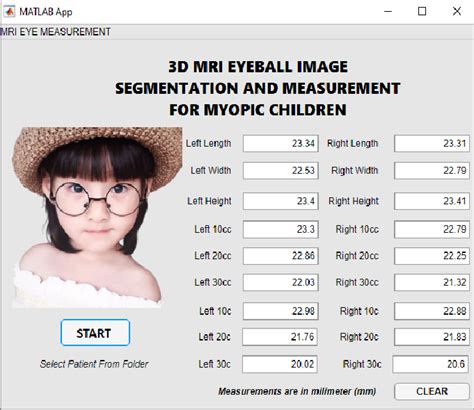 Display Values On Gui Download Scientific Diagram