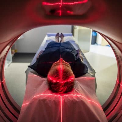 Deep Learning Model For Creating Synthetic CT From MRI In Head And Neck Cancer Patients