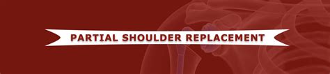 Partial Shoulder Replacement Rohini Heights