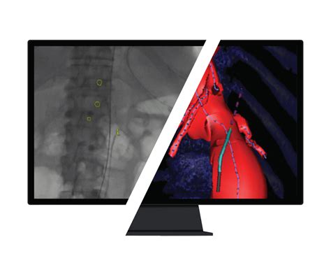 IOPS Technology Centerline Biomedical