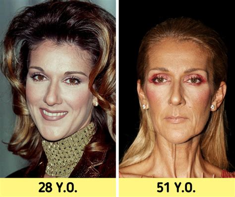 Young Celine Dion Nose