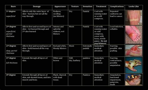 Burn Chart Ems At Maria Gibbs Blog