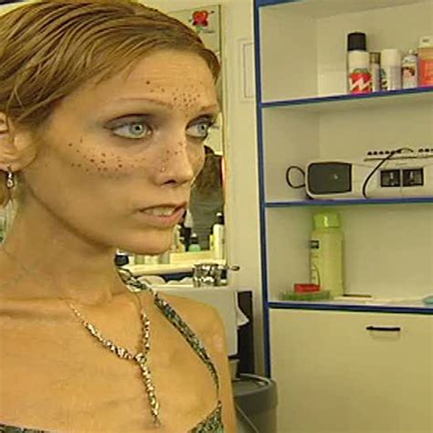 Isabelle Caro Antes De La Anorexia 37 Fotos E Imágenes De Alta