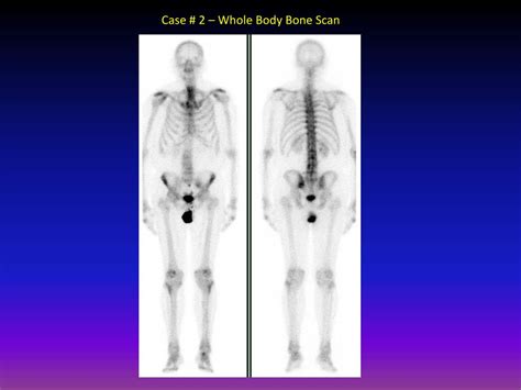 PPT Overview Of SPECT CT Applications PowerPoint Presentation Free Download ID 1063744