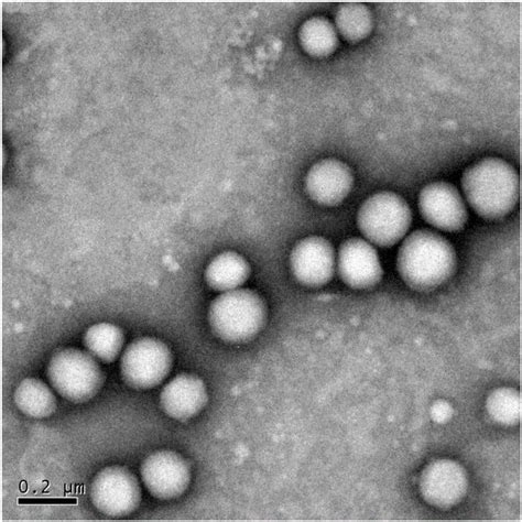 Slow Release Nano Drug Carrier As Well As Preparation Method And Application Thereof Eureka