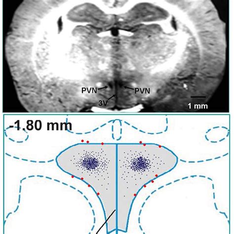 Tracing Showing The Effect Of Pvn Microinjection Of Saline In Sham And Download Scientific