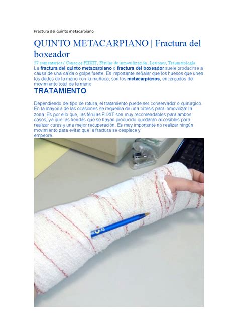 Fractura Del Quinto Metacarpiano Es Importante Señalar Que Los Huesos Que Unen Los Dedos De La