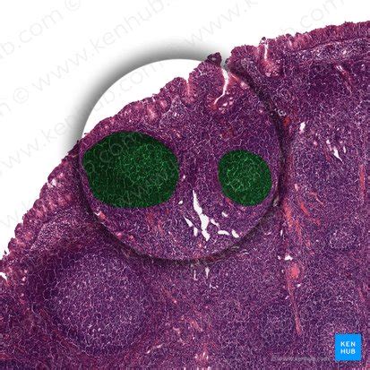 Linfonodos Anatomia Histologia E Função Kenhub